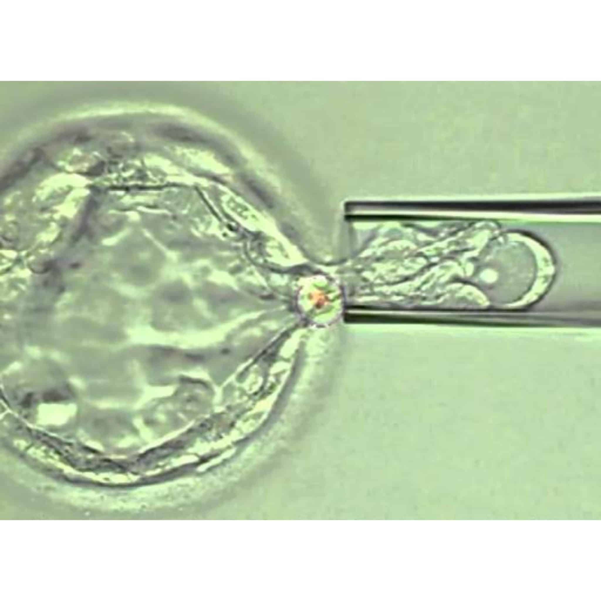 Láser LYKOS DTS Hamilton Thorne Precisión en FIV y biopsia embrionaria ...
